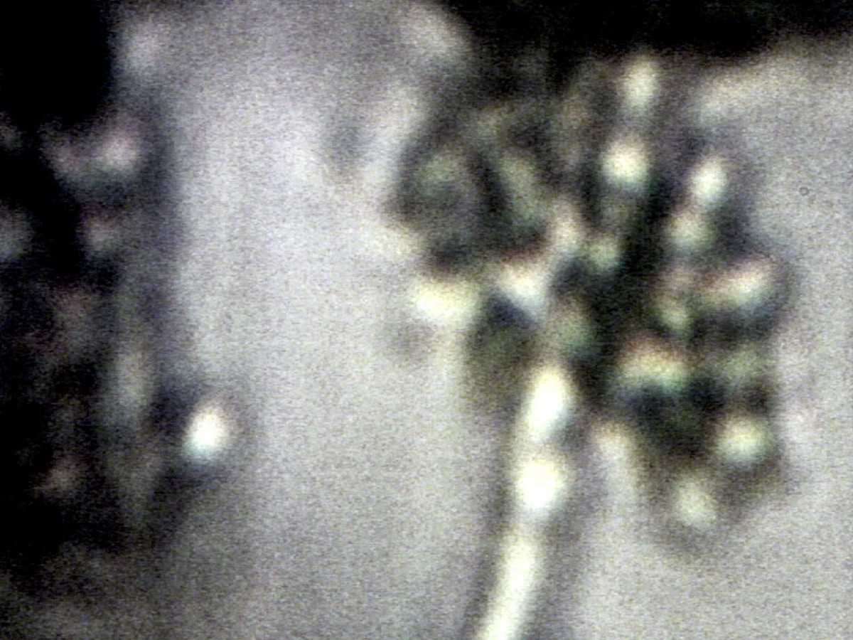 MORGELLONS AND RECENT FINDINGS – Carnicom Institute