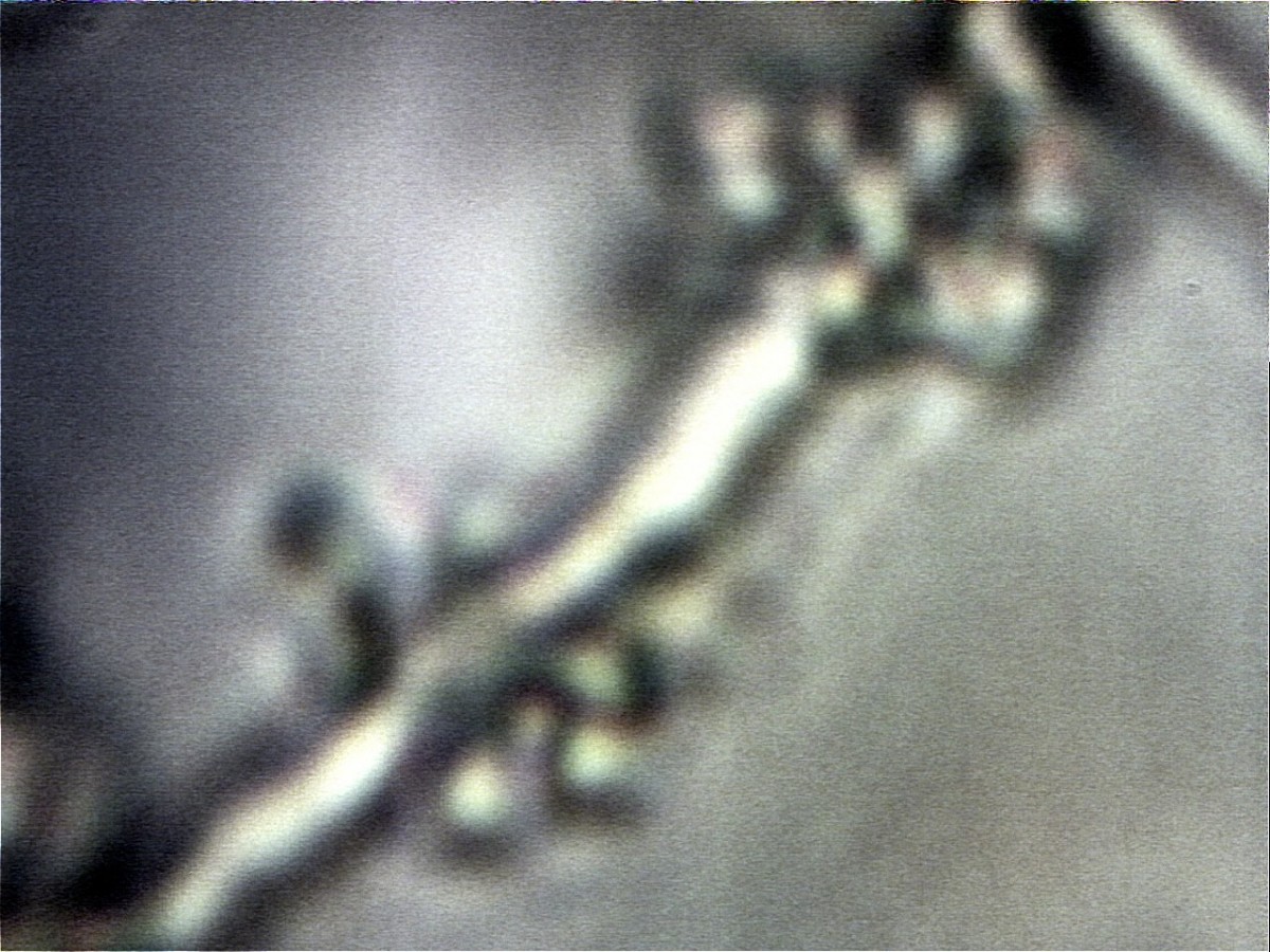 MORGELLONS AND RECENT FINDINGS – Carnicom Institute
