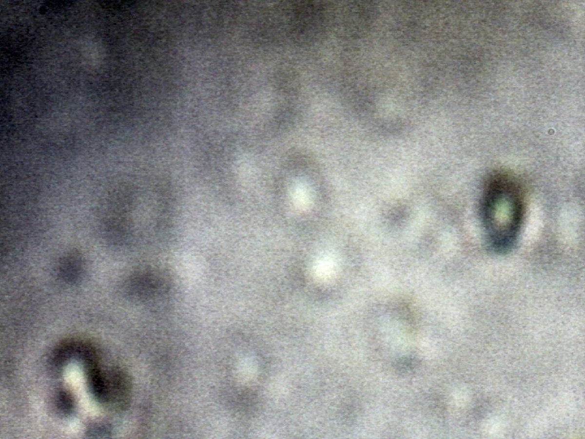 MORGELLONS AND RECENT FINDINGS – Carnicom Institute
