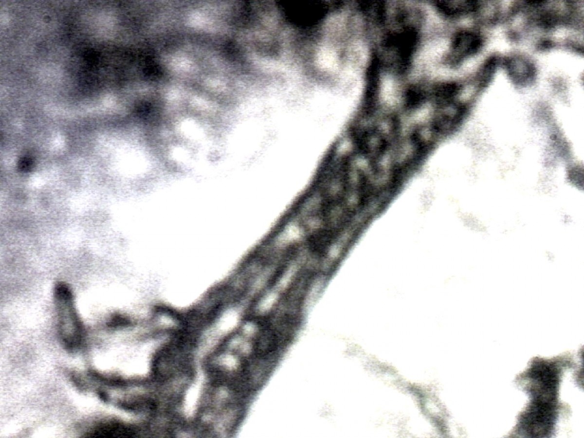 MORGELLONS AND RECENT FINDINGS – Carnicom Institute